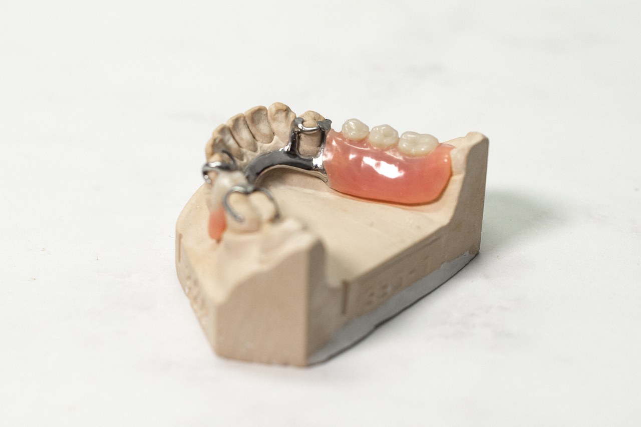 Onze services - Tandprothetische praktijk van Kralingen