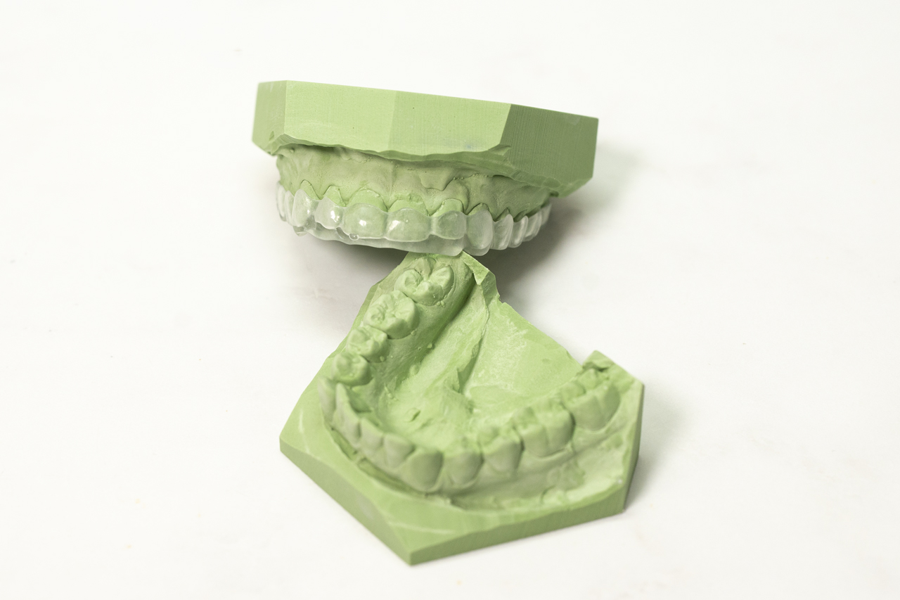 Onze services - Tandprothetische praktijk van Kralingen